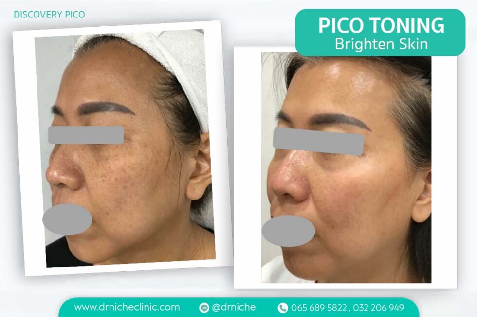 วิธีเลือก 5 โหมดการรักษา Discovery PICO ช่วยอะไรบ้าง?